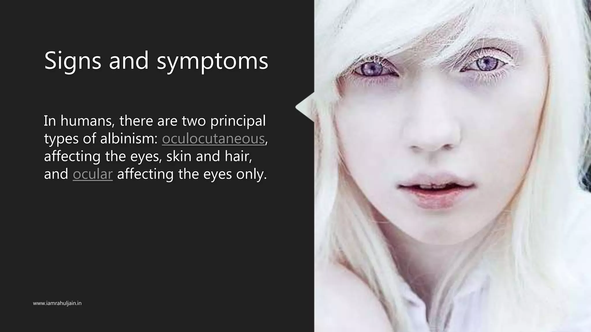 International Albinism Awareness Day IAAD, 13 June | PPTX