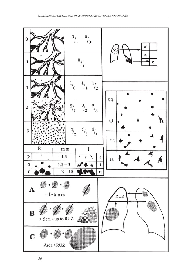 International classification of radiograph | PDF