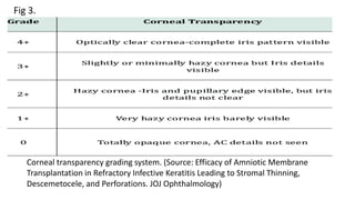 INTERNSHIP Presentation1.On physiology of the eye pptx | PPTX