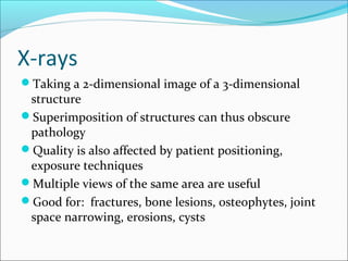 Joint X-Ray | PPT