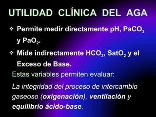 Interpretación de aga | PPS