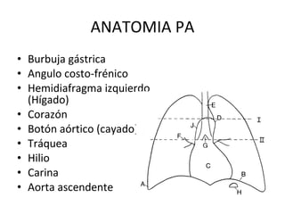 (2012-01-24)Interpretación de radiología toracica basica.ppt