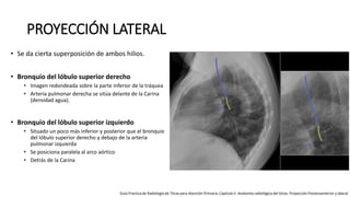 Interpretación de Radiografía de Tórax.. | PPTX