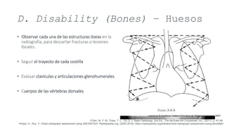 Interpretación de Radiografía de Tórax.. | PPTX