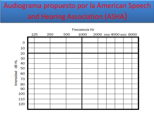 Interpretación de un audiograma audiol. gea