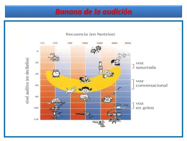 Interpretación De Un Audiograma Audiol Gea