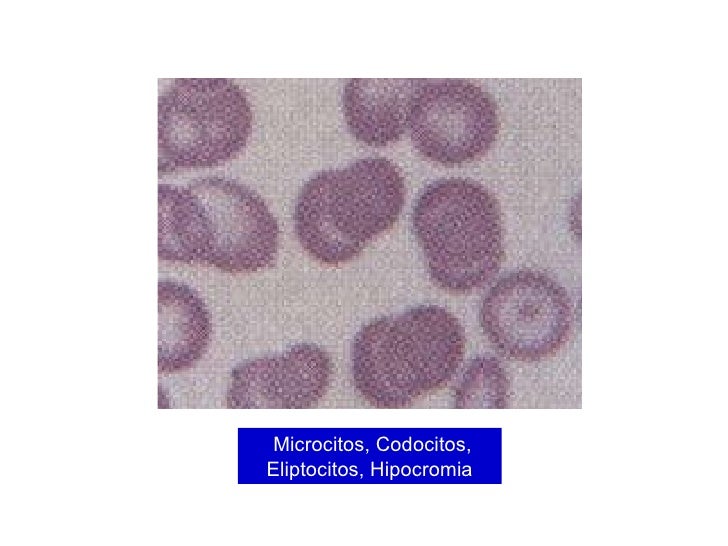 Interpretación hemograma