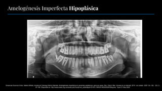 Interpretación Radiográfica de Anomalías Dentales | PDF