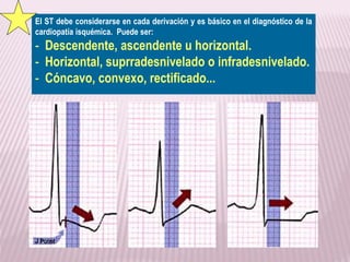 Interpretacion del ekg | PPTX