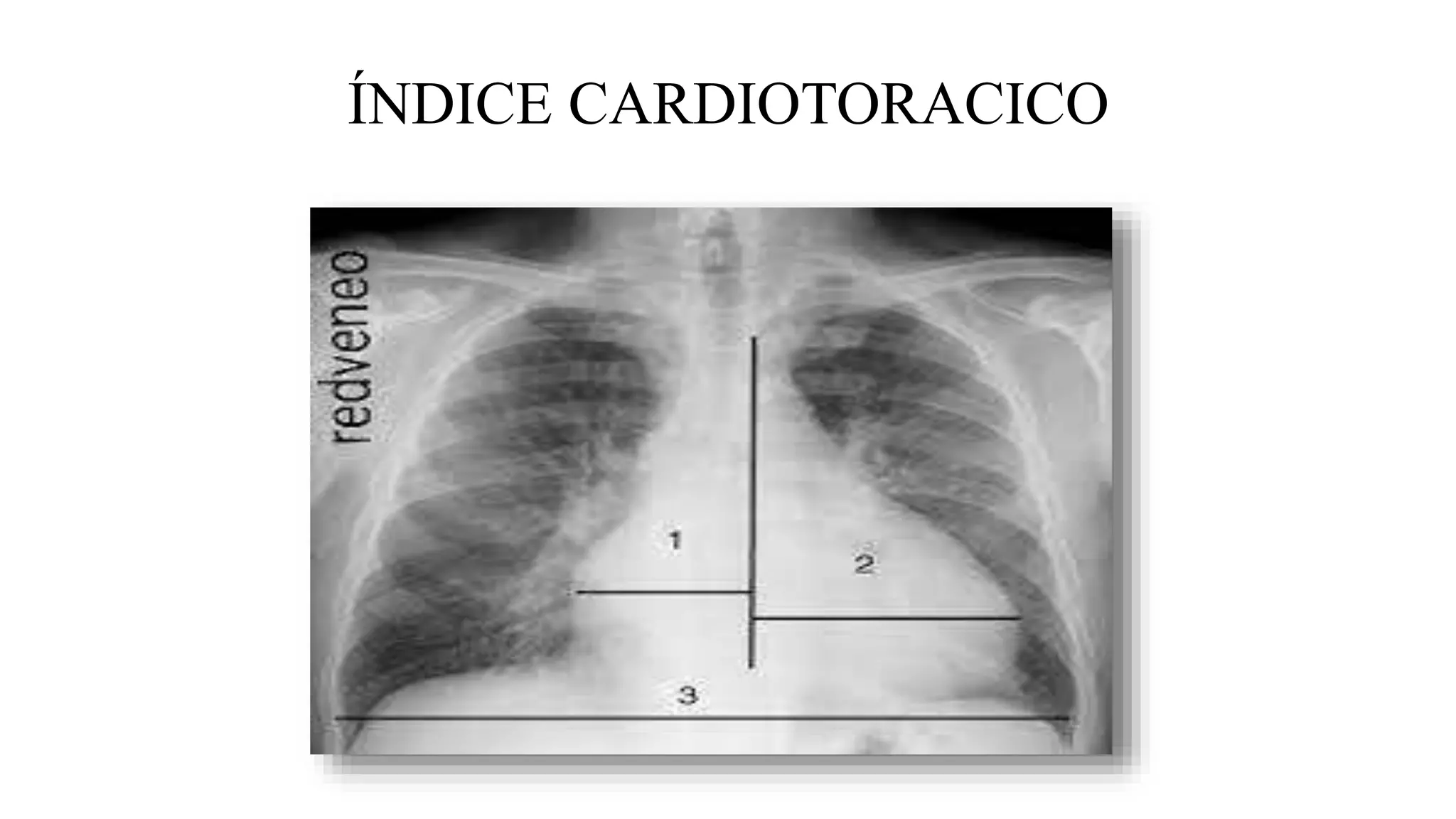 Interpretacion de rx y tac expo sicion | PPTX