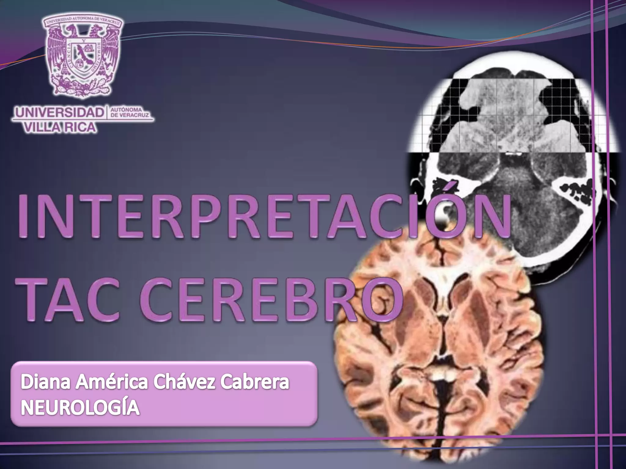 INTERPRETACION DE ANATOMIA CEREBRAL EN UNA TAC CRANEAL | PPTX