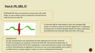 INTERPRETACION SISTEMATICO DE ECG.pptx