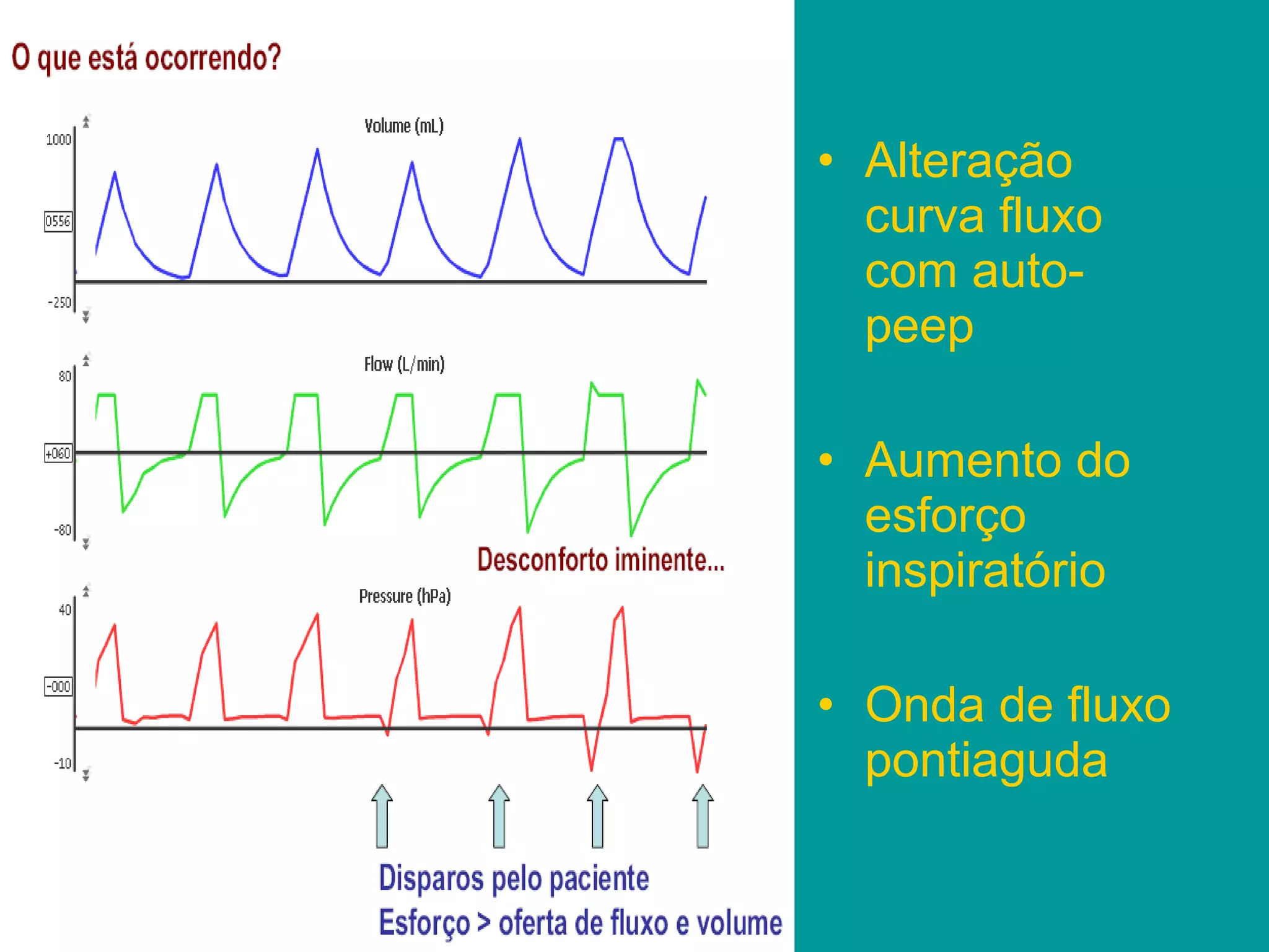Interpretação de curvas e loops em ventilação mecânica | PPT