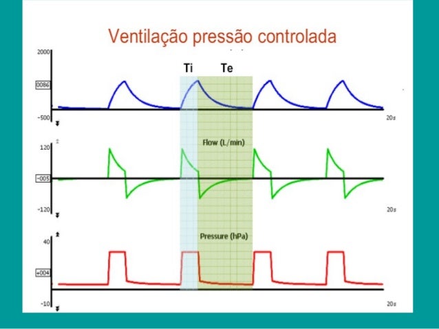 Interpretação de curvas e loops em ventilação mecânica
