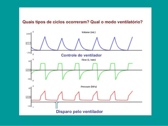 Interpretação de curvas e loops em ventilação mecânica