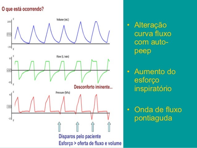 Interpretação de curvas e loops em ventilação mecânica