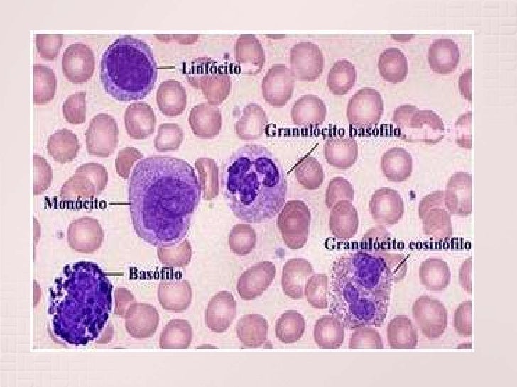 Interpretacion De Hemograma Leucocito Anemia