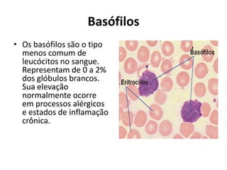 Interpretação do hemograma | PDF