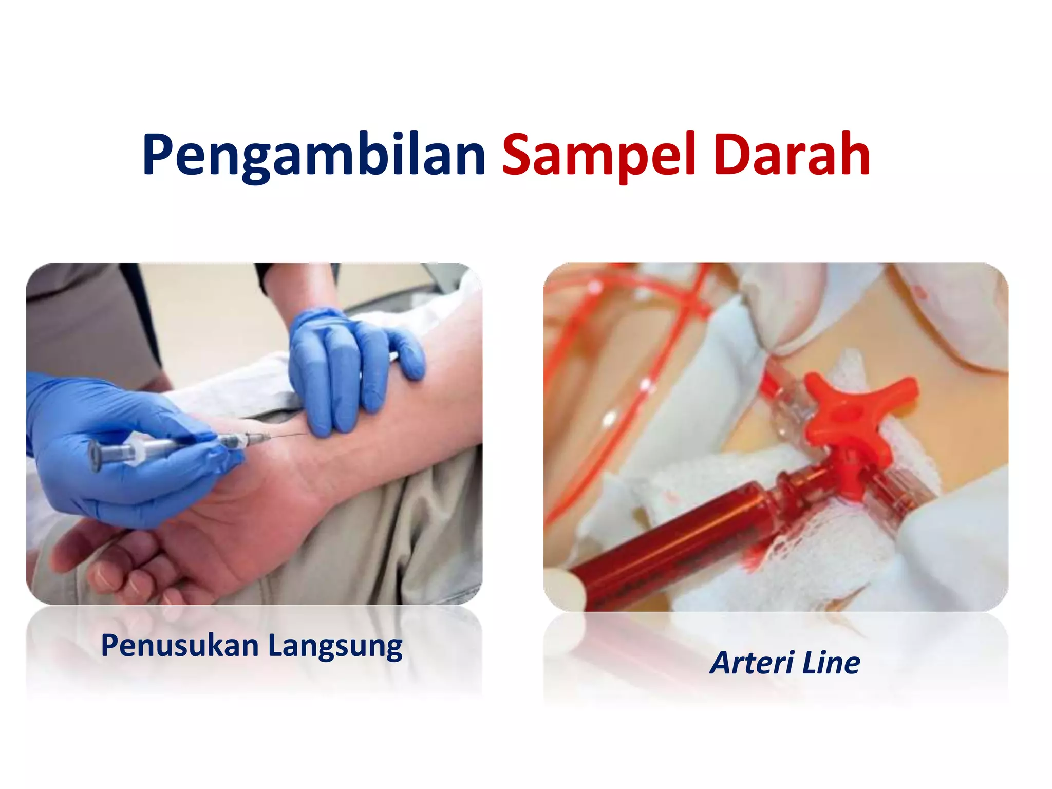 INTERPRETASI AGD PICU-2022.docx