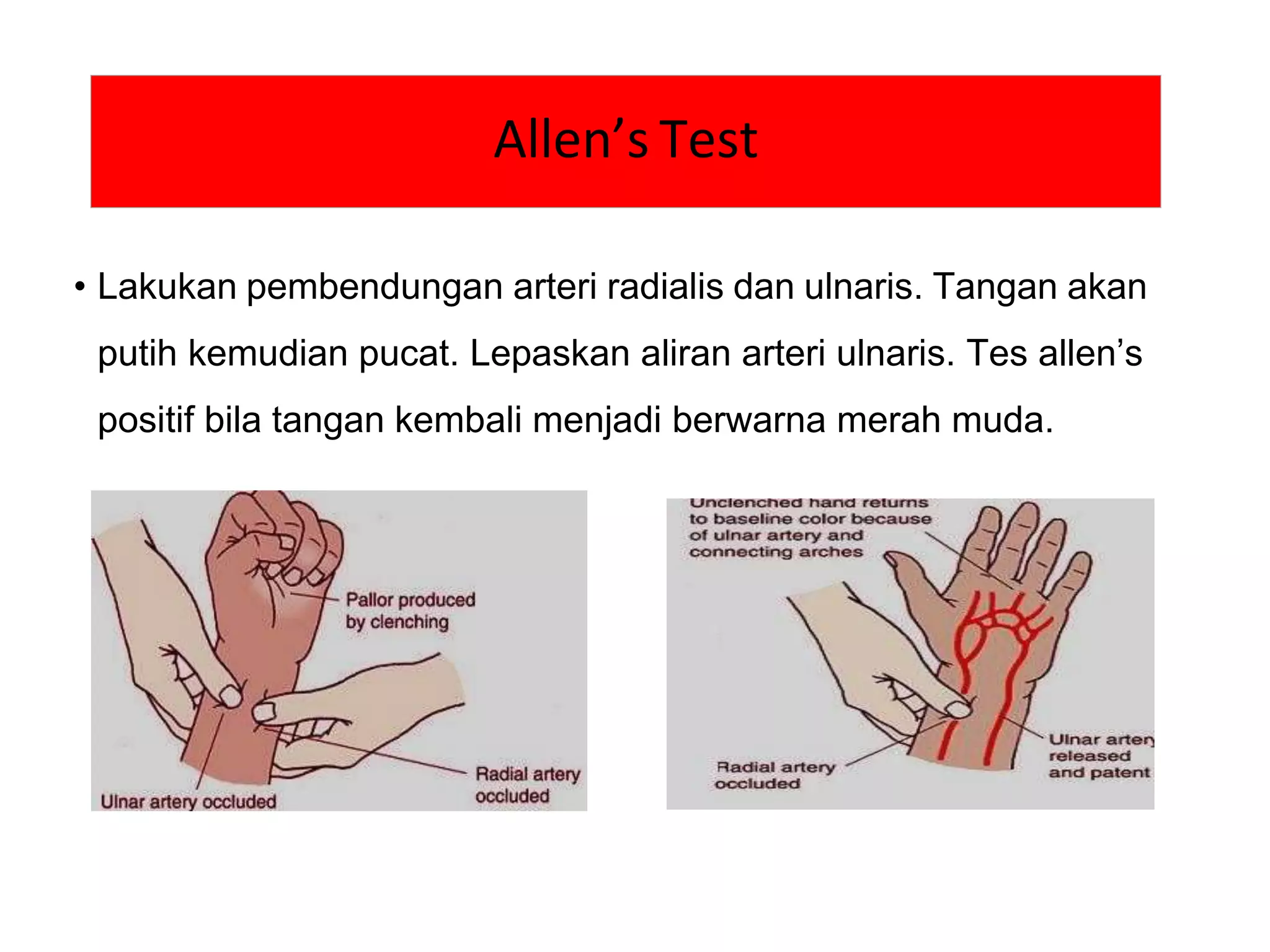 INTERPRETASI AGD PICU-2022.docx