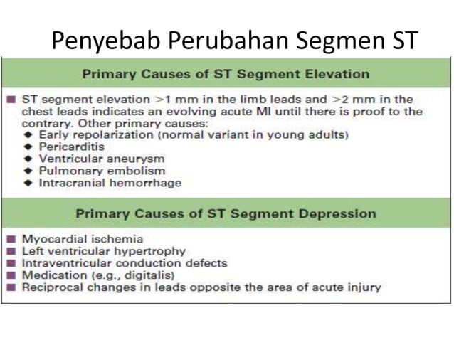 INTERPRETASI EKG 12 LEADS Infarct & Ischemia.pptx