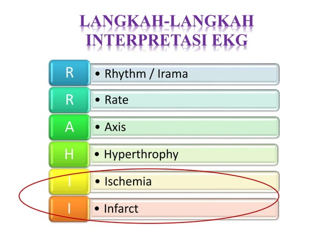 INTERPRETASI EKG 12 LEADS Infarct & Ischemia.pptx