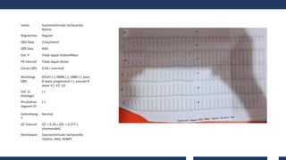 interpretasi ekg stase kardio perifer RSAA.pptx