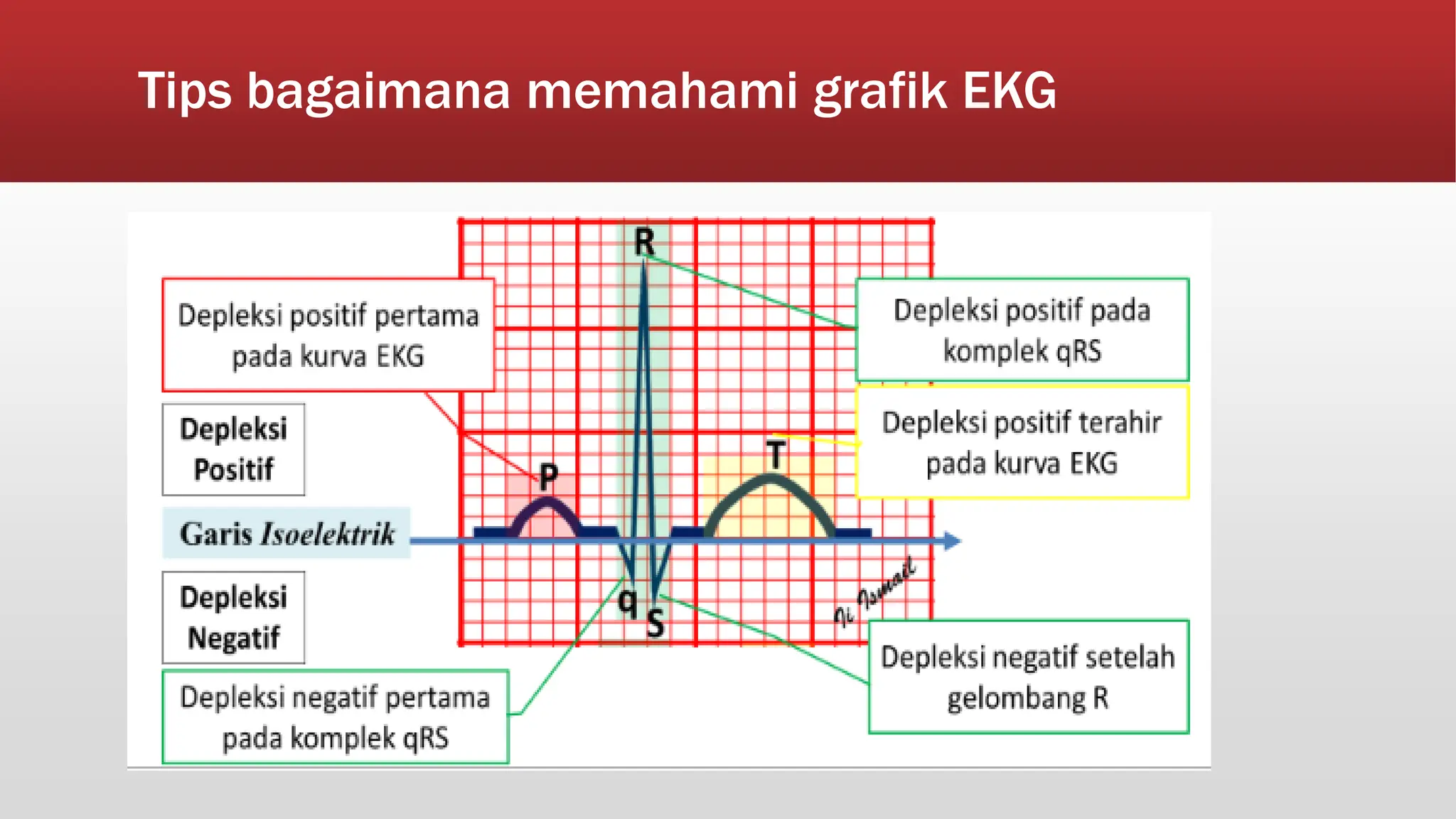 INTERPRETASI ELEKTROKARDIOGRAFI (EKG)_2023.pdf