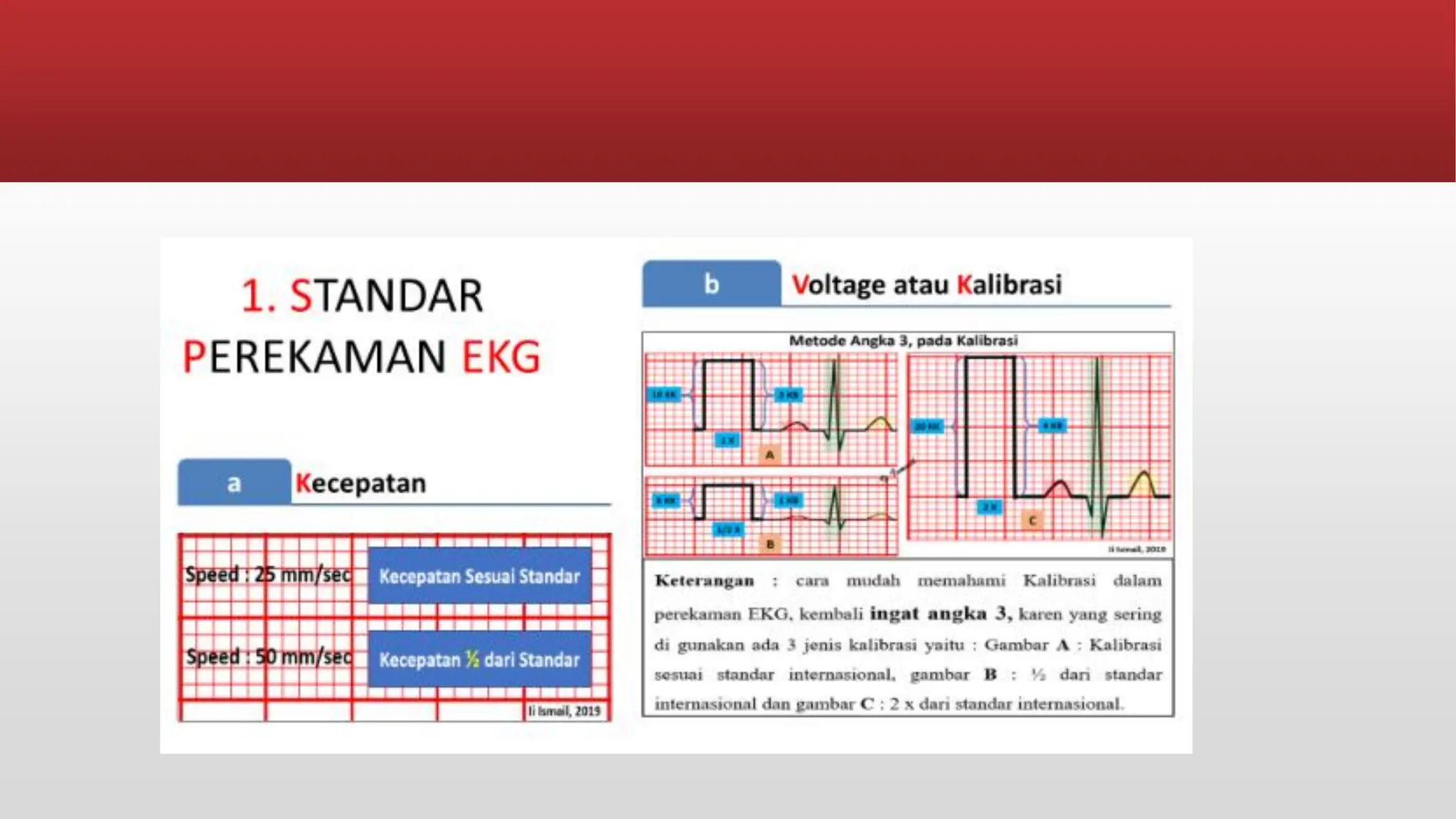 INTERPRETASI ELEKTROKARDIOGRAFI (EKG)_2023.pdf