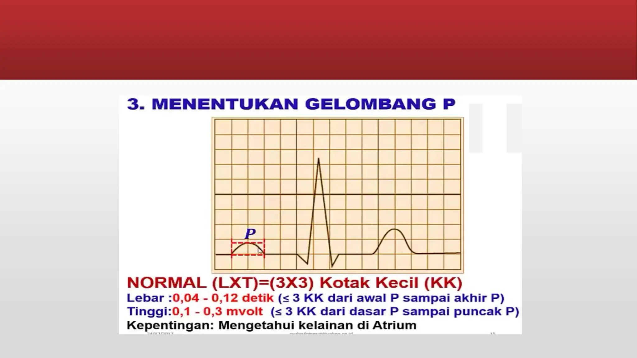 INTERPRETASI ELEKTROKARDIOGRAFI (EKG)_2023.pdf