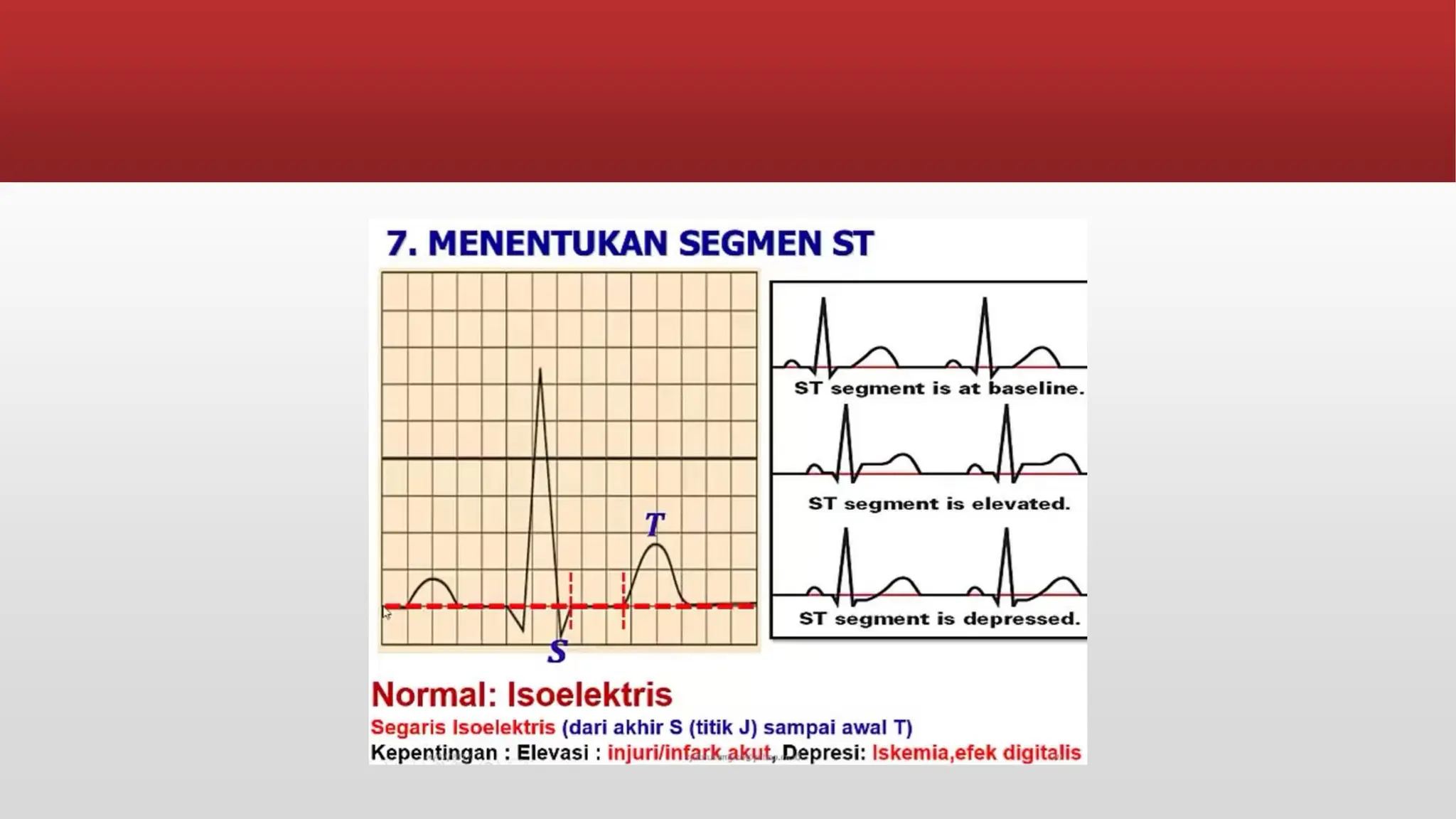 INTERPRETASI ELEKTROKARDIOGRAFI (EKG)_2023.pdf