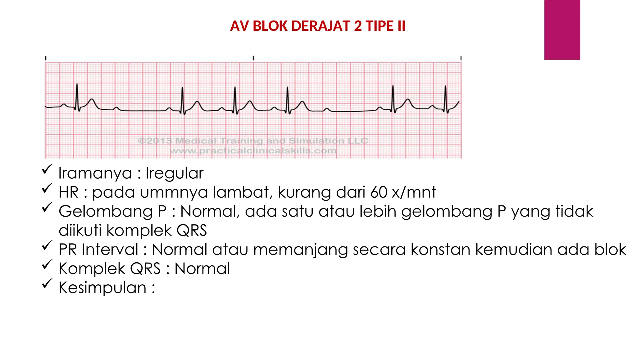 Interpretasi Gambaran EKG Bagi pemula.ppt