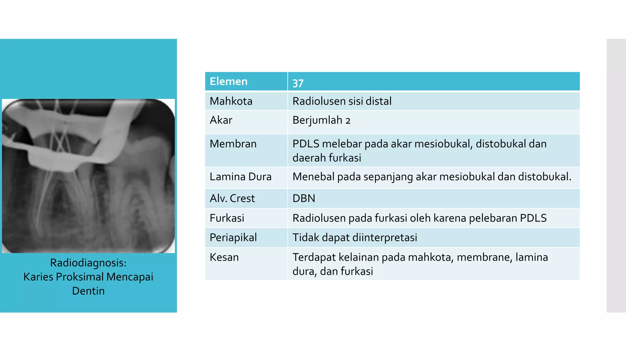 Interpretasi Radiografi Periapikal.pptx
