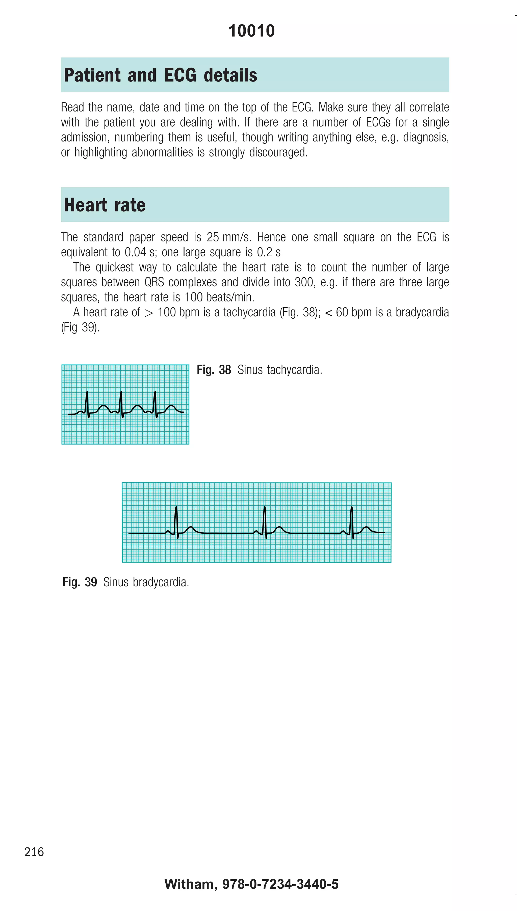 ECG Interpretation | PDF