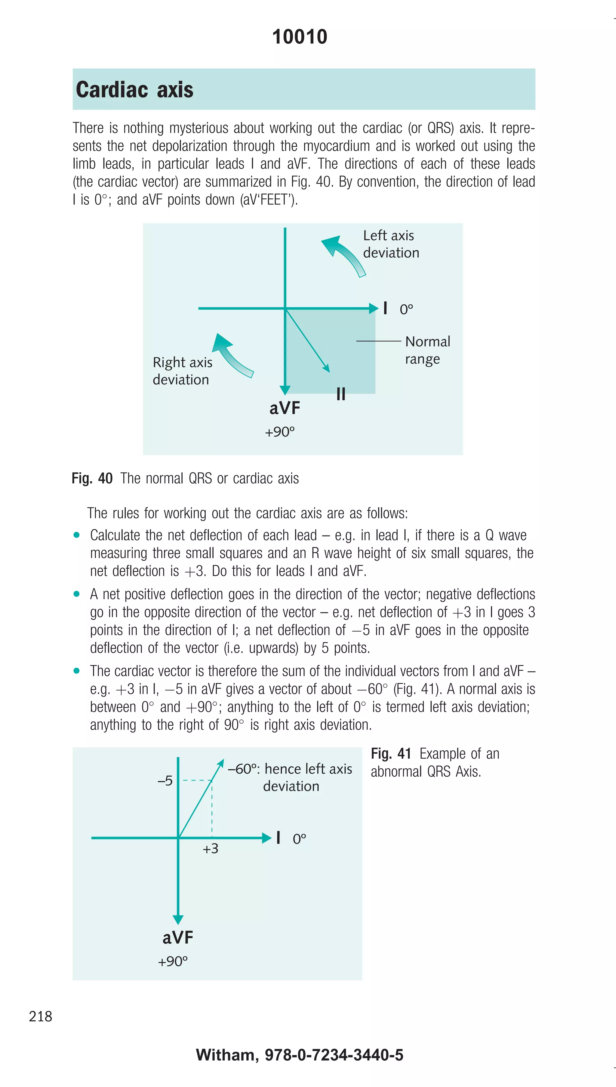 ECG Interpretation | PDF