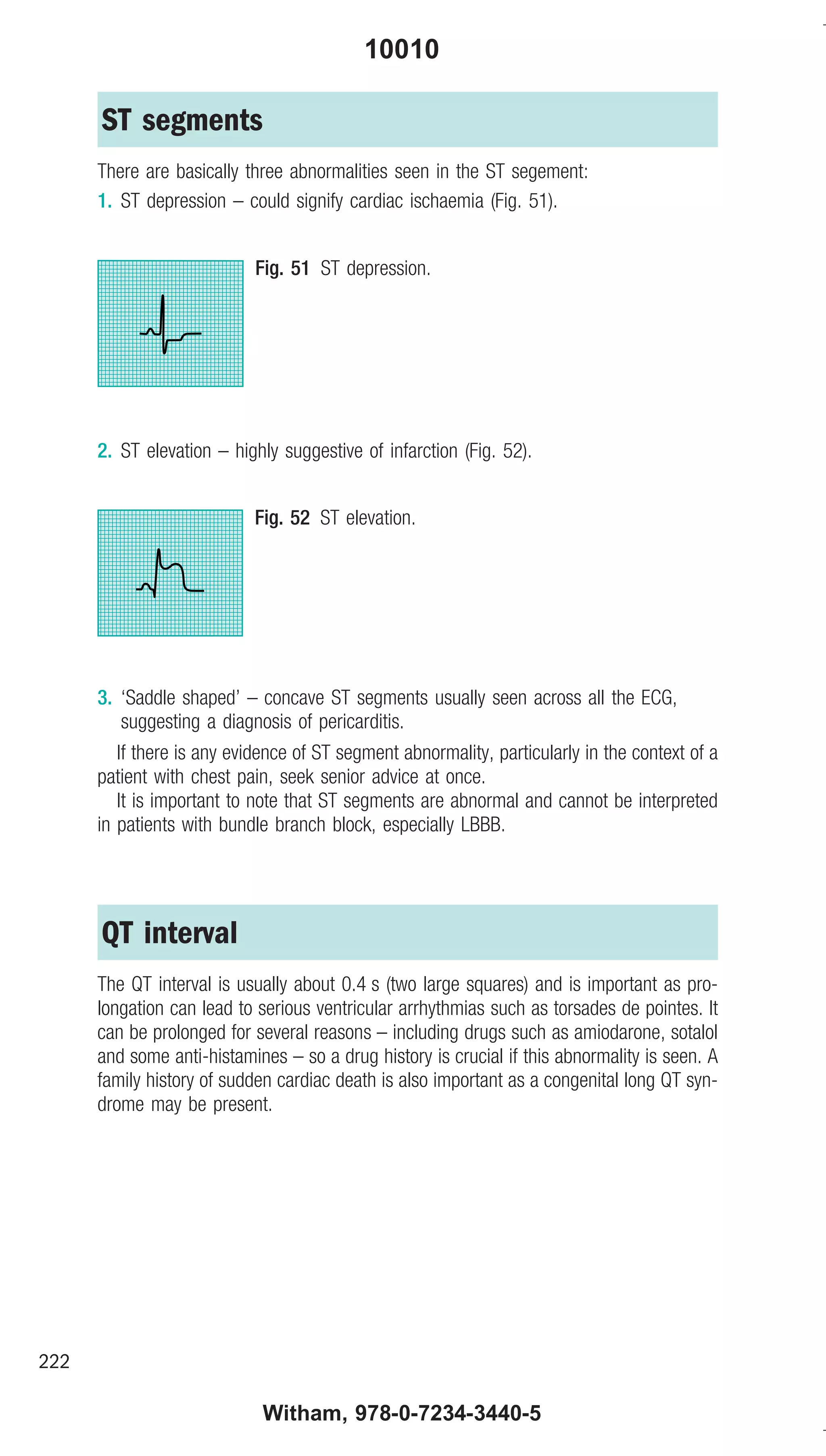 ECG Interpretation | PDF