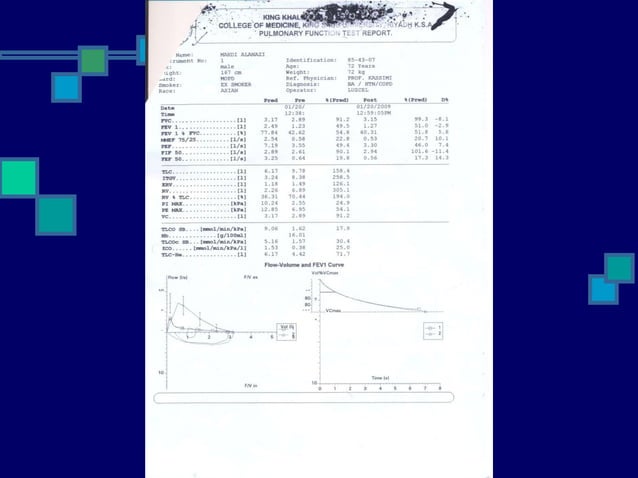 Interpretation OF PFT | PPT