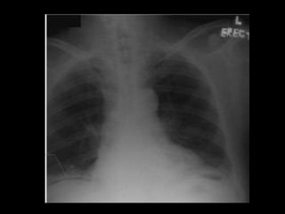 Interpretation of x ray in disease process | PPTX