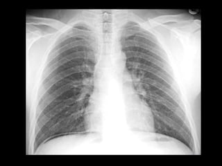 Interpretation of x ray in disease process | PPTX