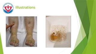 Interpretation a general urinalysis in a clinical case.pptx