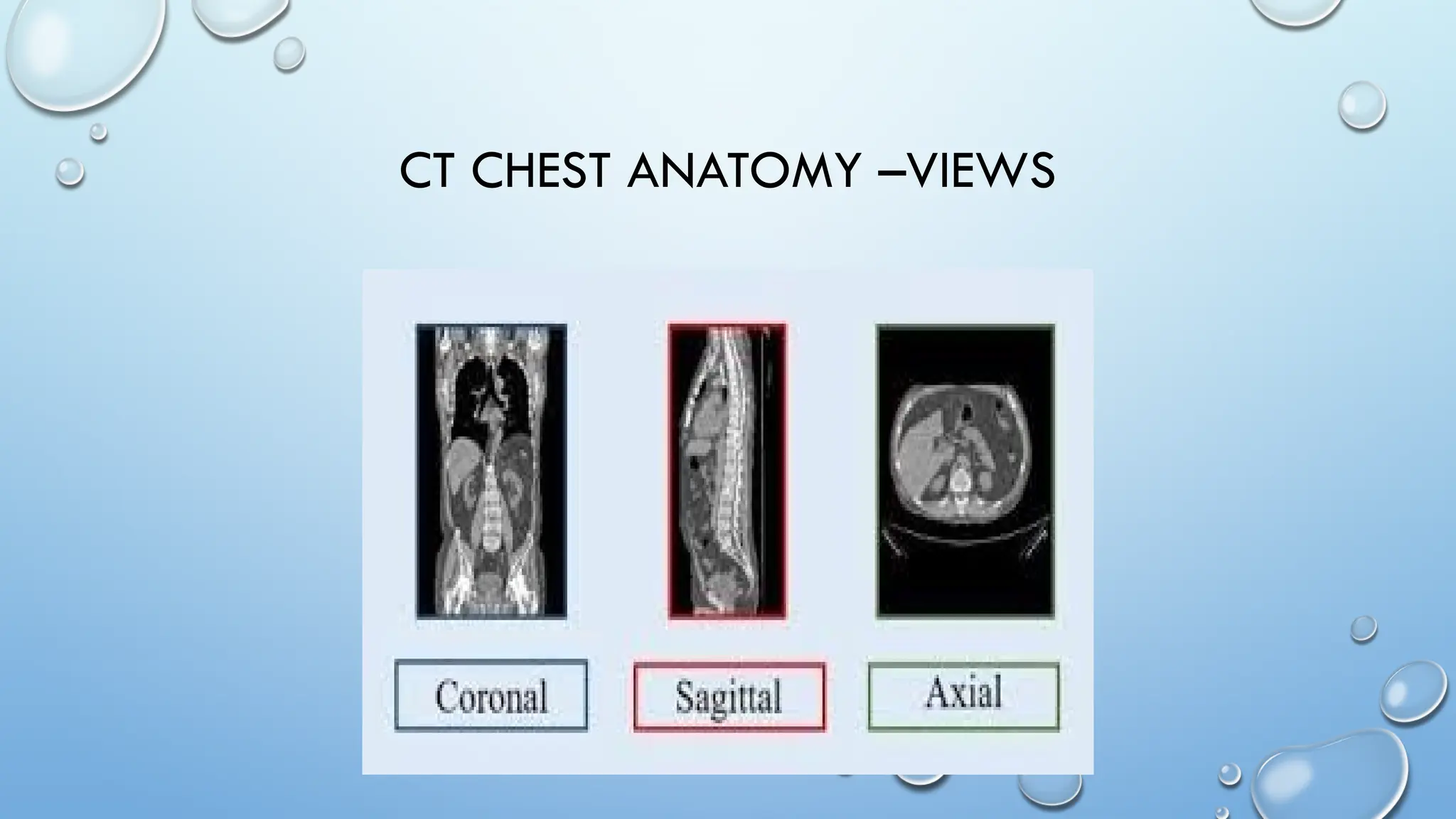 Interpretation of anatomy of chest x-ray and ct-chest.pptx