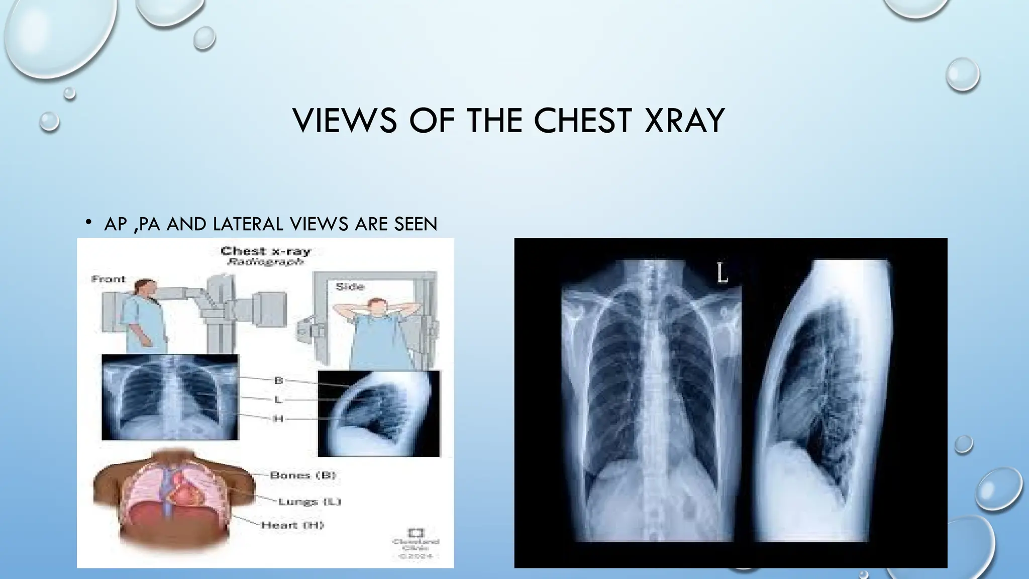 Interpretation of anatomy of chest x-ray and ct-chest.pptx