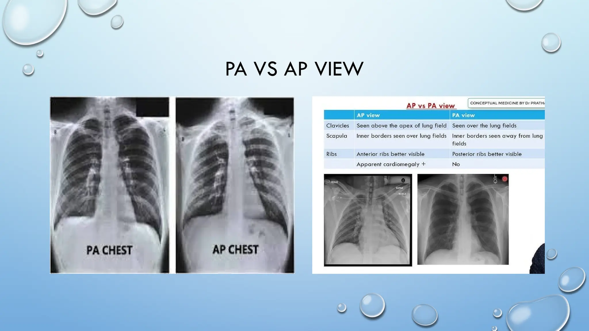 Interpretation of anatomy of chest x-ray and ct-chest.pptx