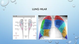 Interpretation of anatomy of chest x-ray and ct-chest.pptx