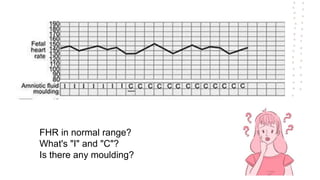 Interpretation of a Partogram.pptx