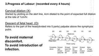 Interpretation of a Partogram.pptx