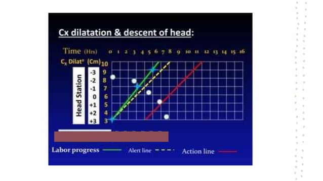 Interpretation of a Partogram.pptx | Pregnancy | Reproductive Health