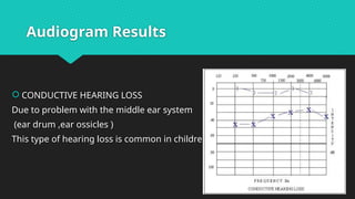 Interpretation of Audiograph in audiometry | PPTX