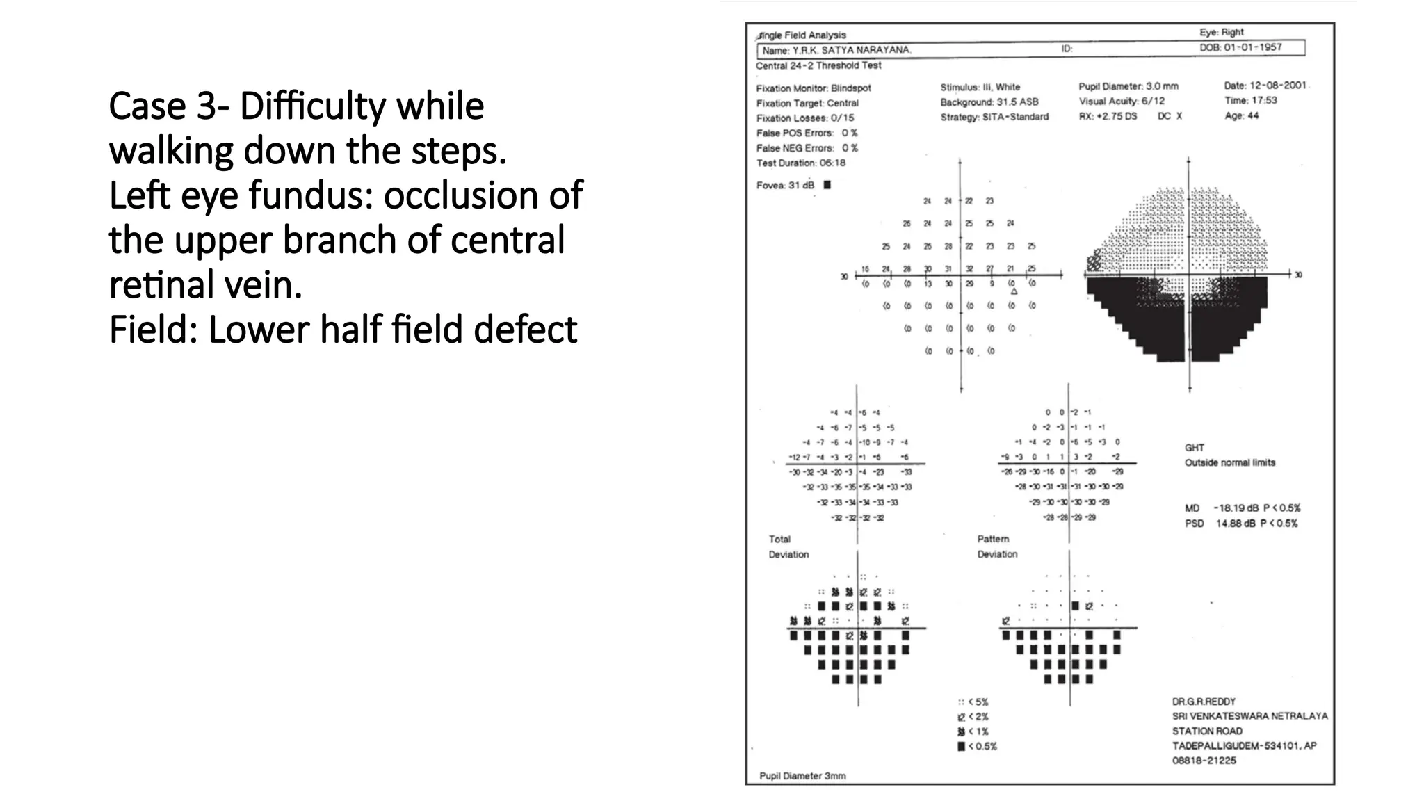 INTERPRETATION OF AUTOMATED PERIMETRY.pptx