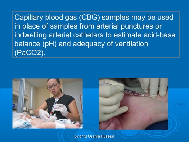 Interpretation of blood gases | PPT